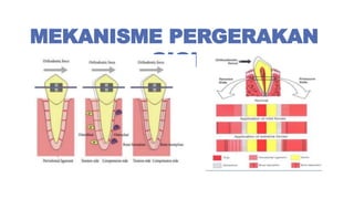 Biomekanik Perawatan Ortodonti pada Sistem Stomatognati | PPTX
