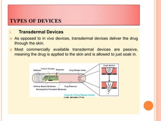 Bio-MEMS | PPTX