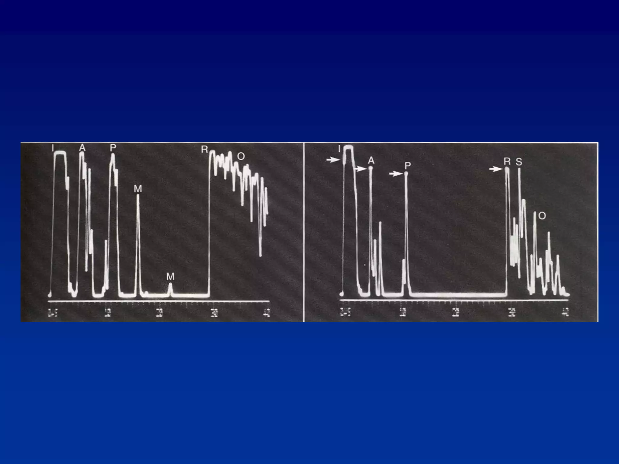 Biometry Pptx