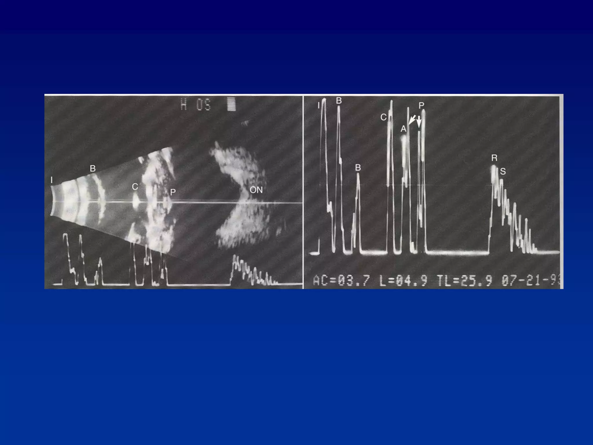 Biometry Pptx