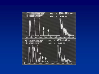 Biometry | PPTX