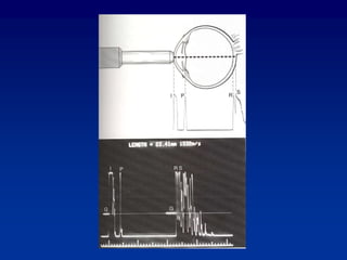 Biometry | PPTX