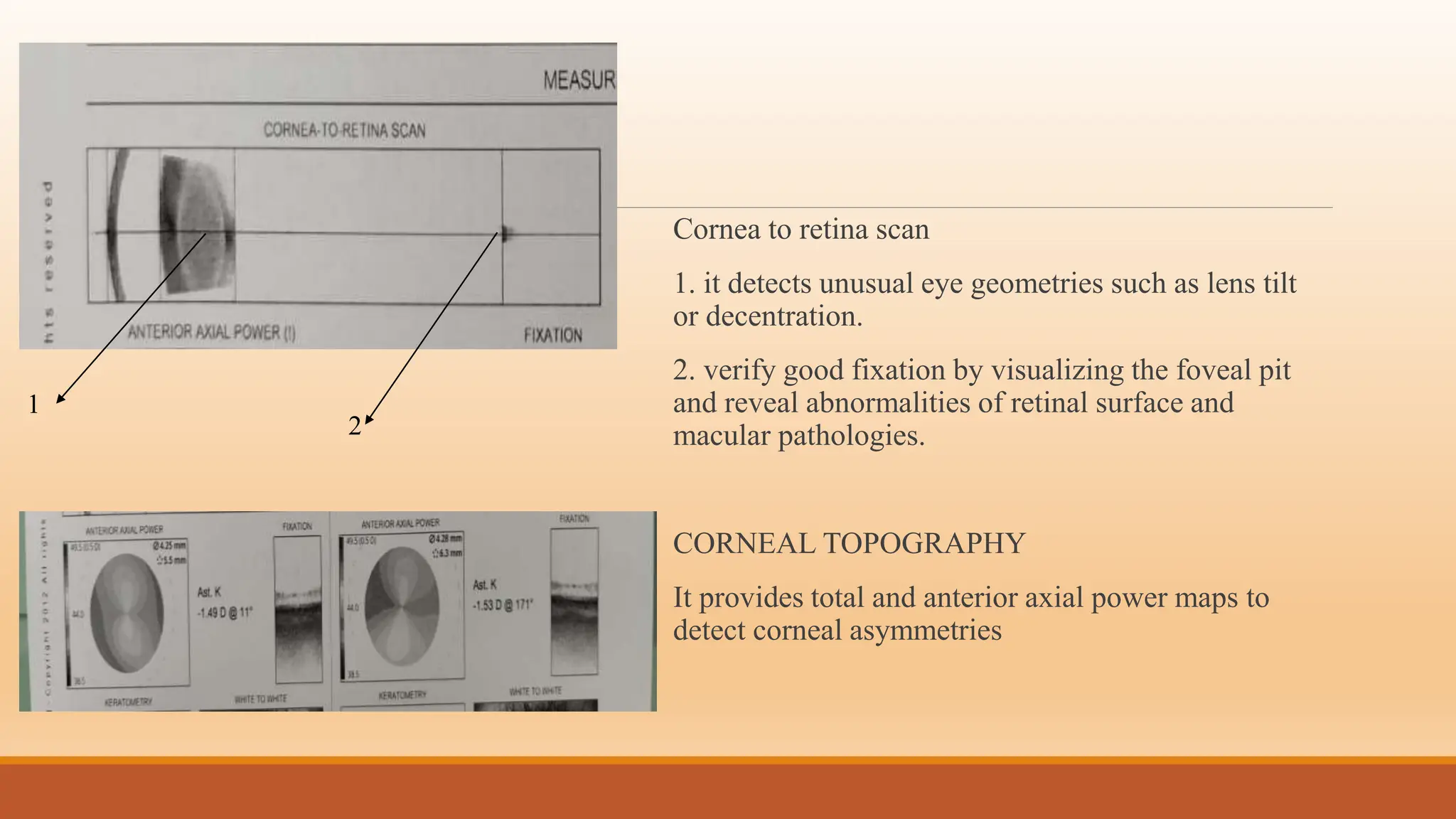 Ocular Biometry- IOL calculation methods | PPTX