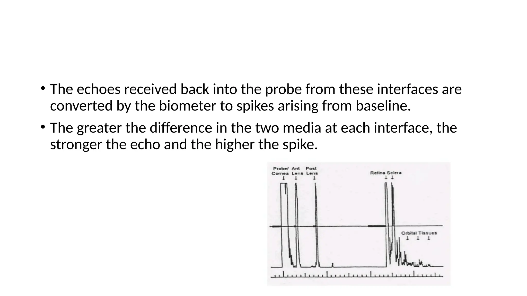 Biometry with basics of keratometry, A scan and iol power calculation ...