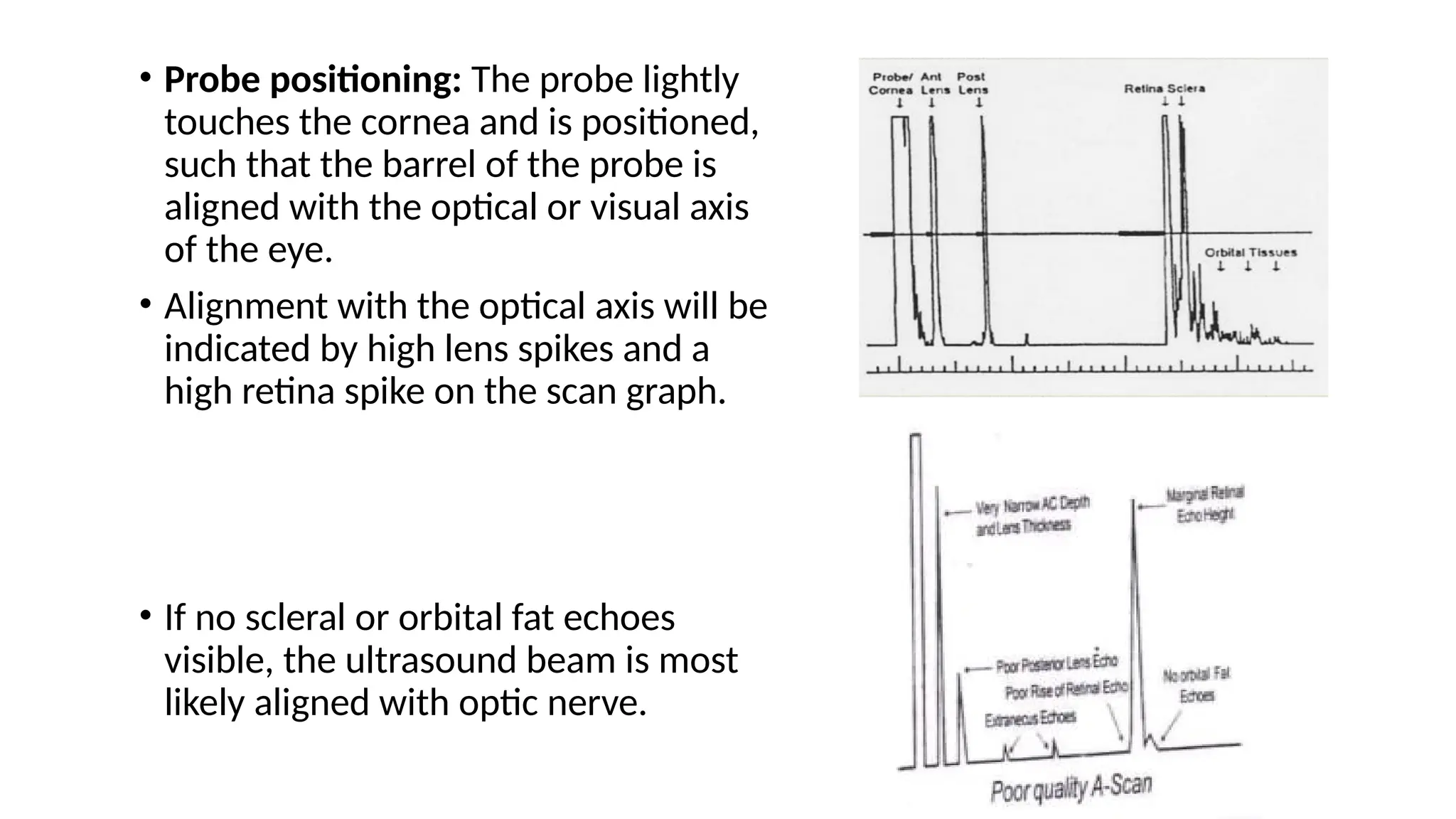 Biometry with basics of keratometry, A scan and iol power calculation ...