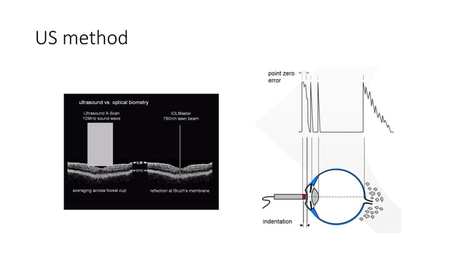 Biometry made easy | PDF | Eye and Vision Conditions | Diseases and ...