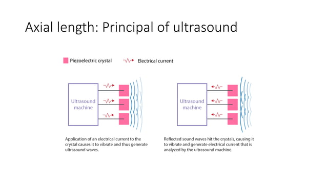 Biometry made easy | PDF | Eye and Vision Conditions | Diseases and ...