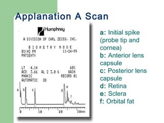 Biometry for Cataract | PPT