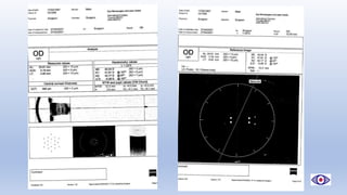 Biometry mistakes and how to avoid | PPTX