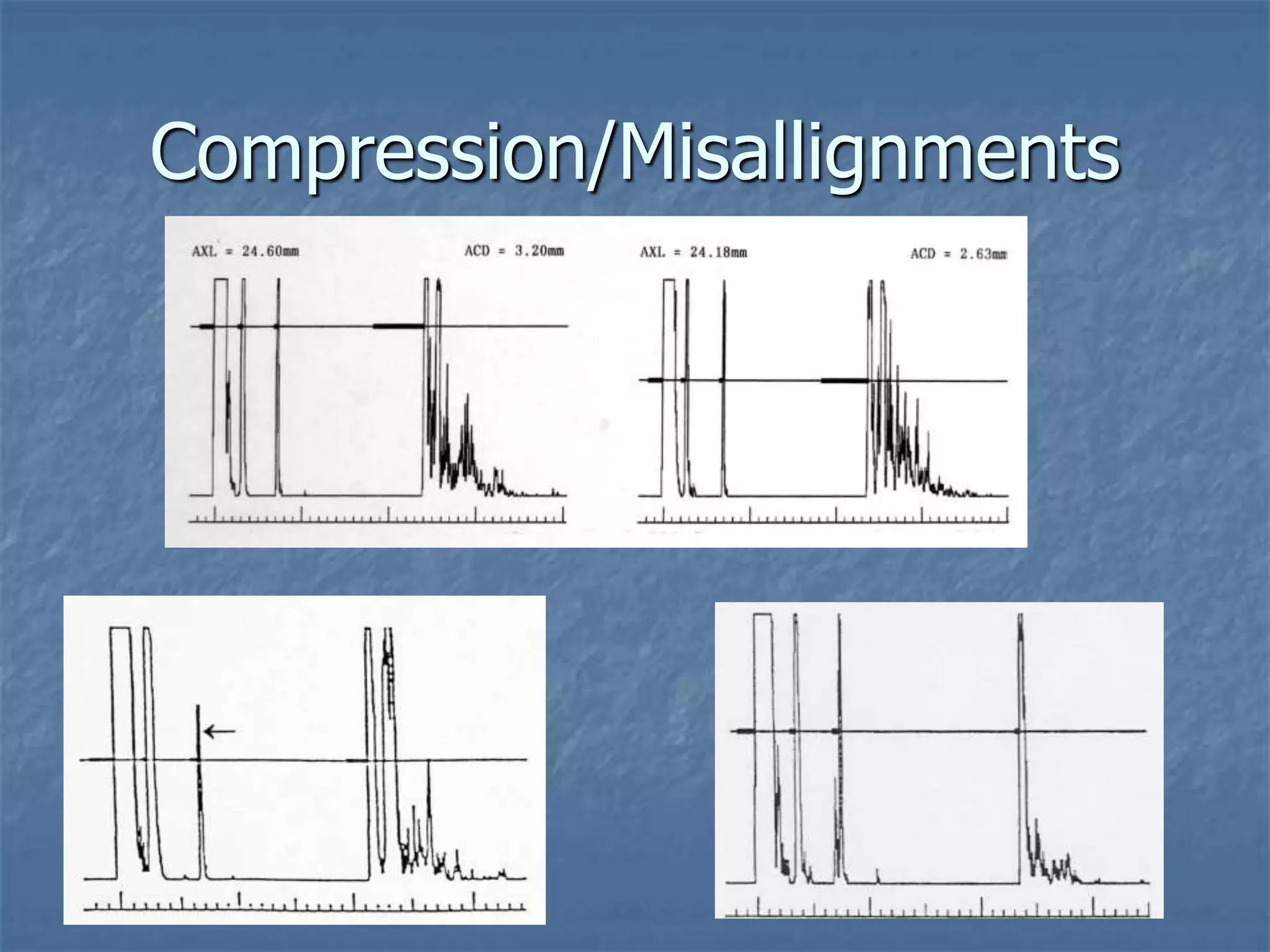 Biometry Yonas.res.ppt