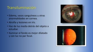 Biomicroscopia con lámpara de hendidura | PPTX