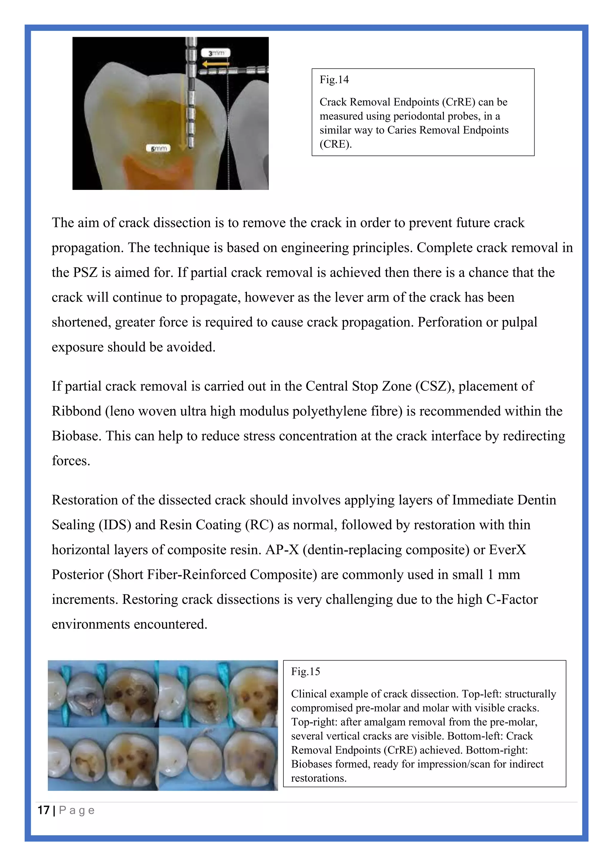 biomimetic restorative dentistry.pdf