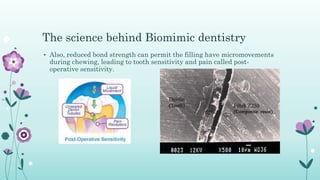 Biomimic Dentistry in modern dentistry and dental materials | PDF