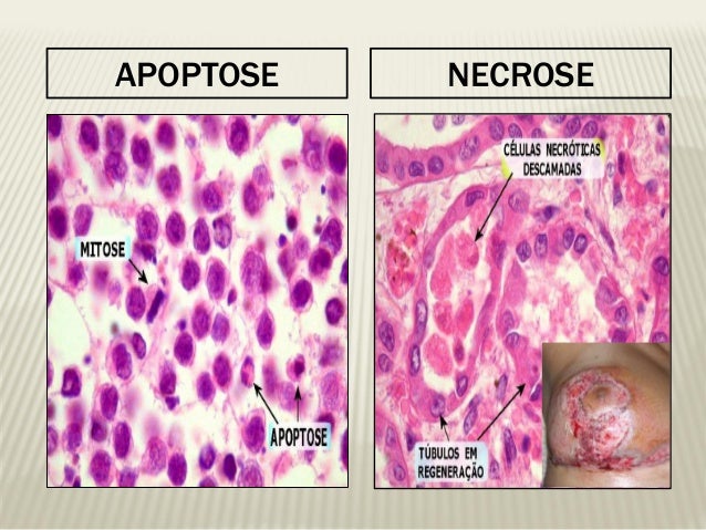 Biologia molecular Apoptose - Quando a célula programa a própria morte