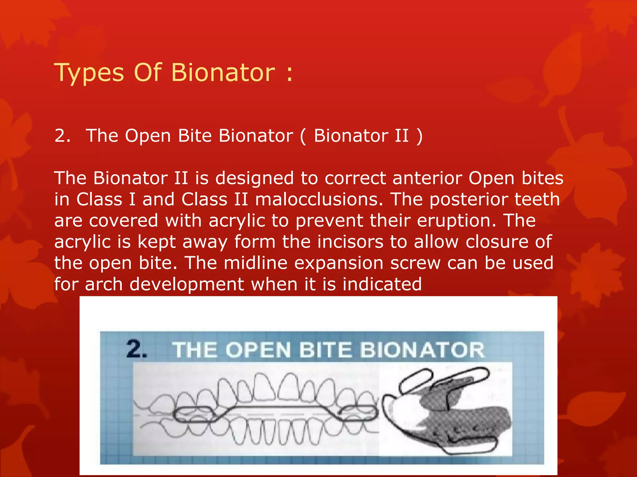 Bionator | PPTX