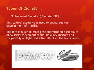 Bionator | PPTX