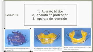 Bionator clase 1,2 y 3 , aparatologia ortopédica para maloclusiones | PPTX