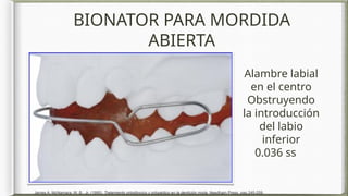 Bionator clase 1,2 y 3 , aparatologia ortopédica para maloclusiones | PPTX