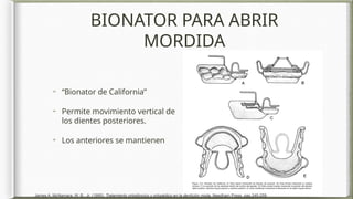 Bionator clase 1,2 y 3 , aparatologia ortopédica para maloclusiones | PPTX