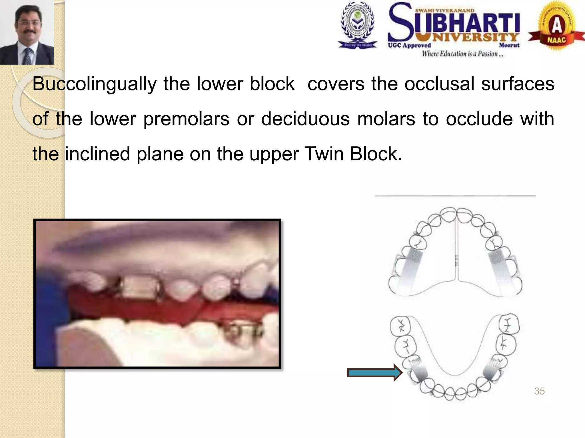 Bionator-&-twin-block-20207311350180.pptx