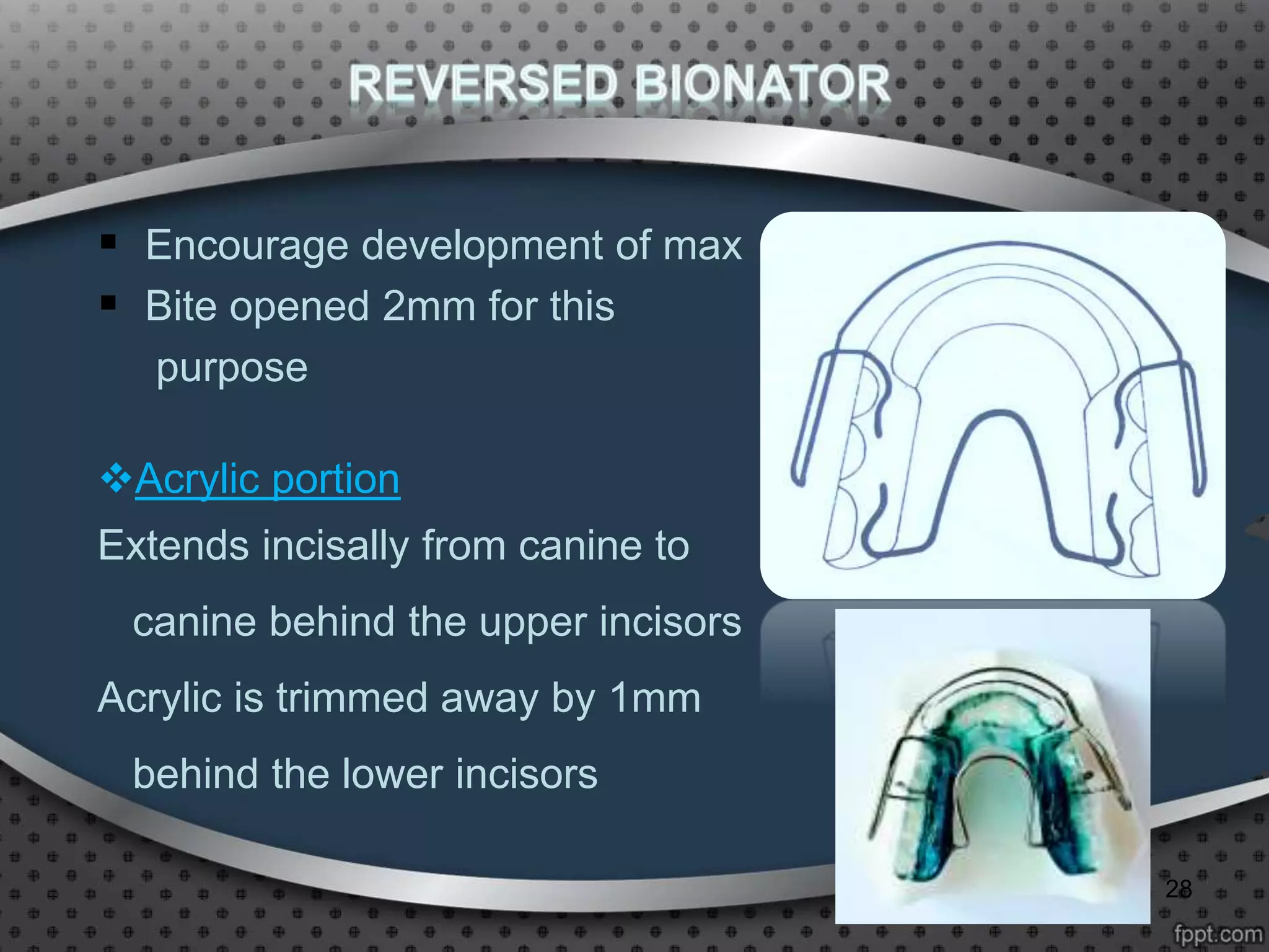 Bionator | PPT