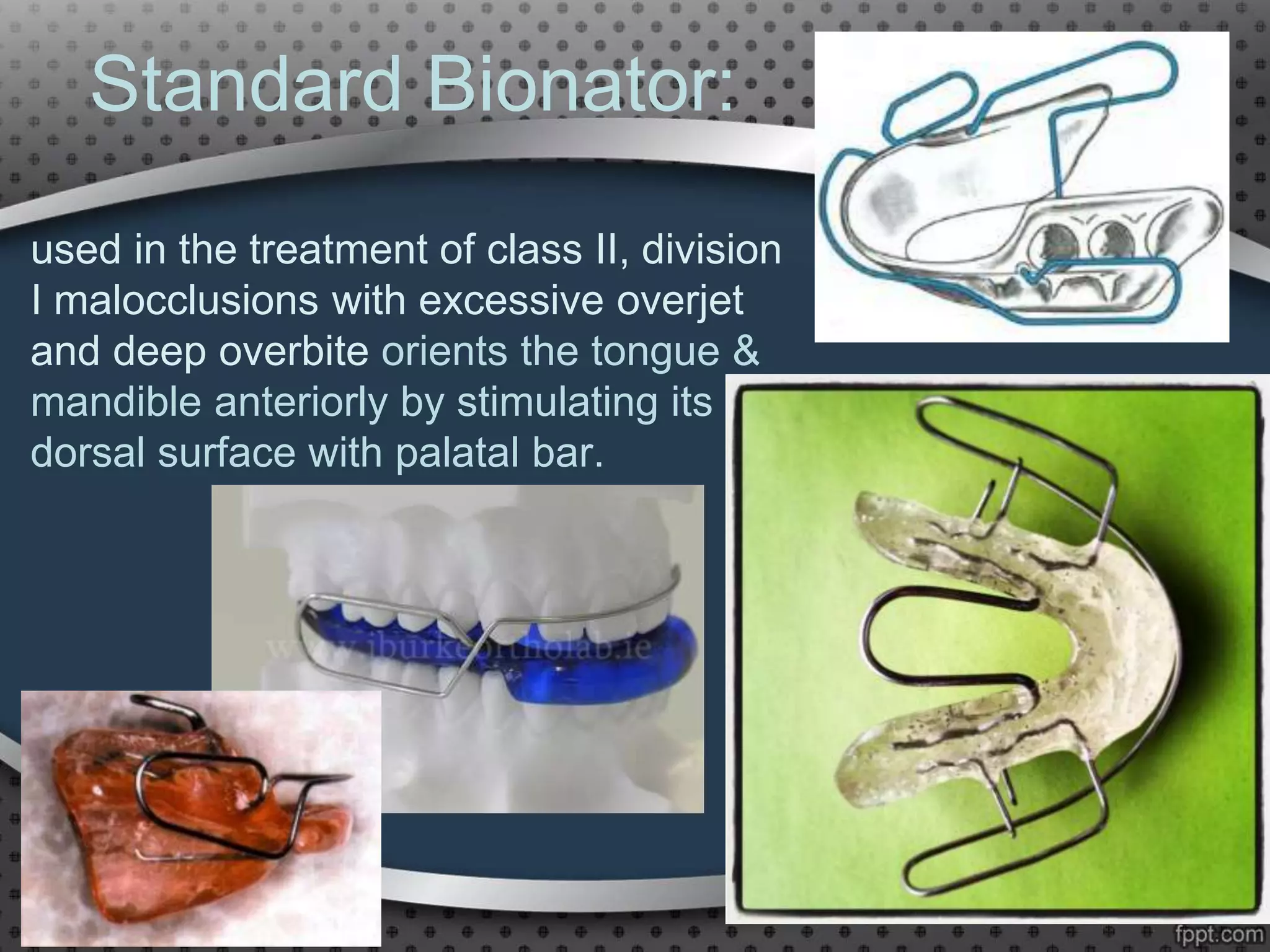 Bionator | PPT