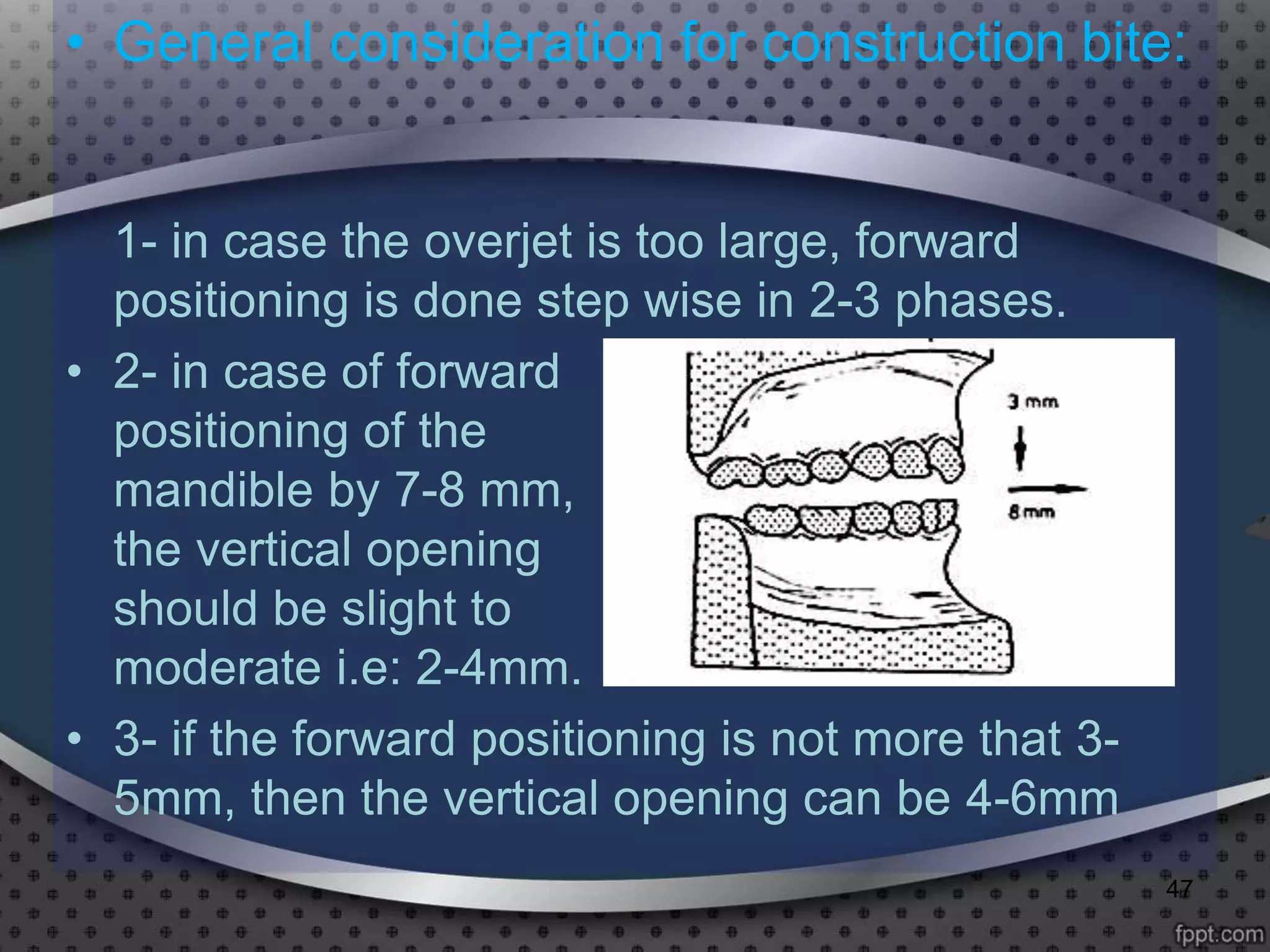 Bionator | PPT