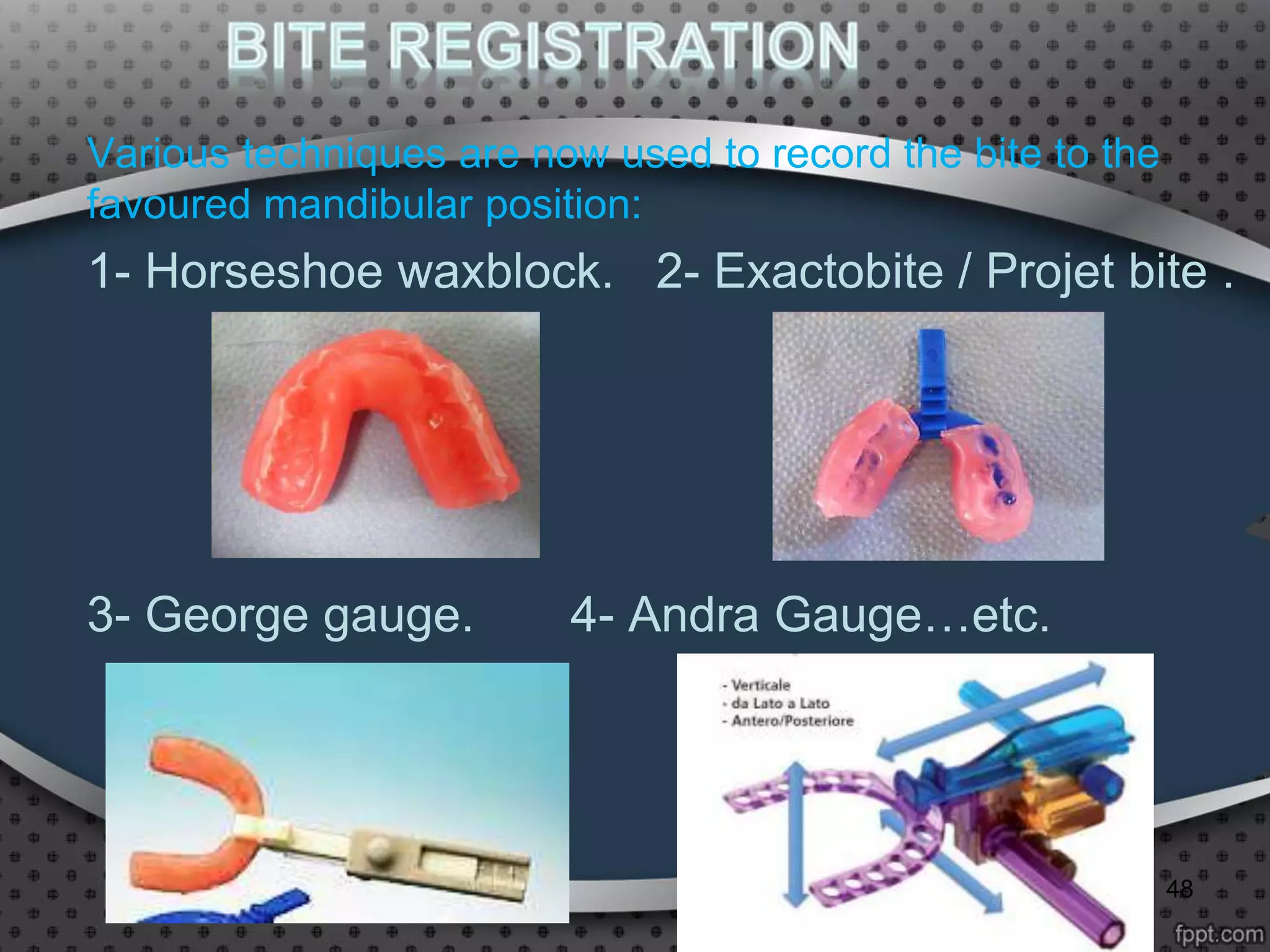 Bionator | PPT