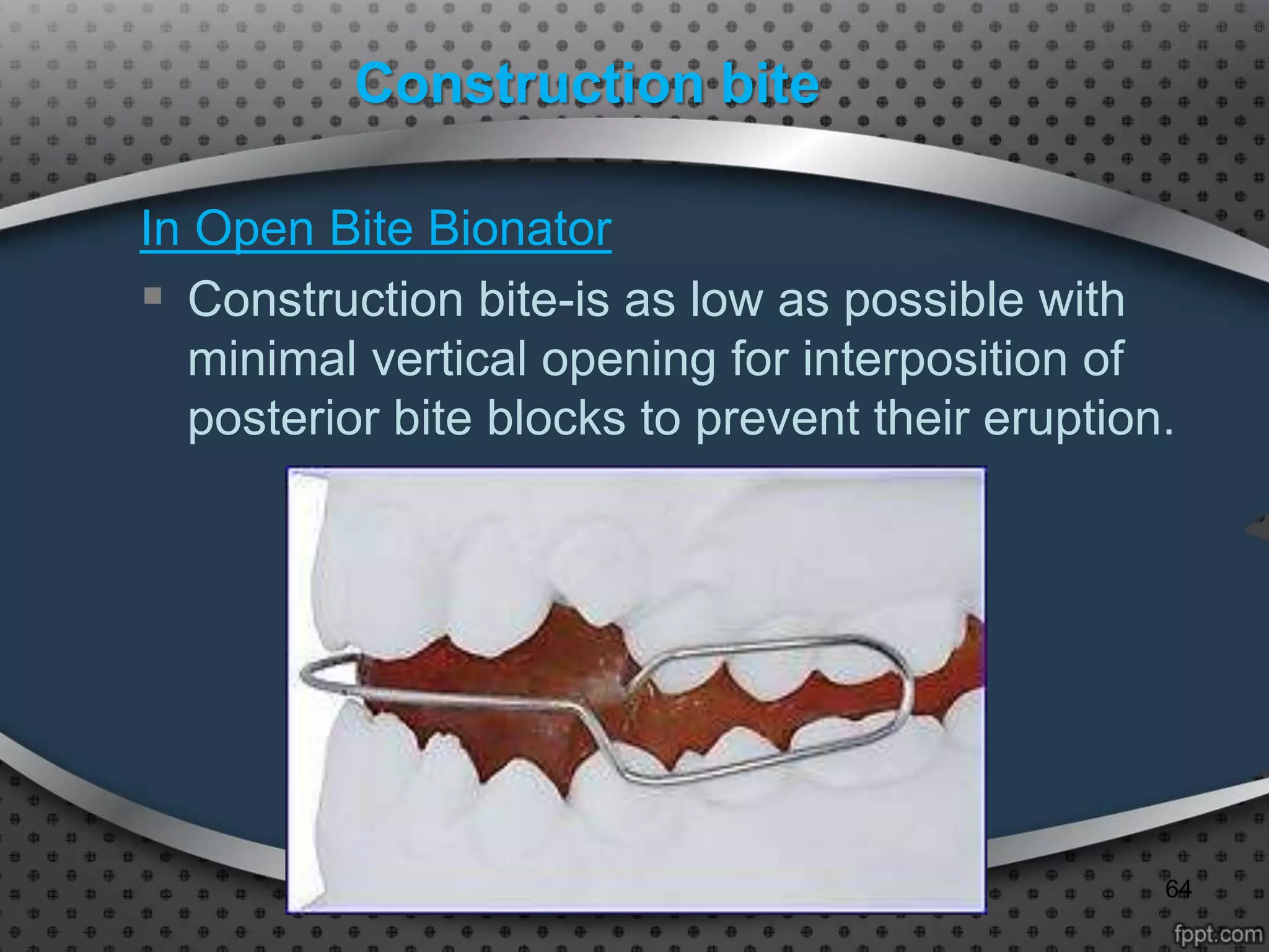 Bionator | PPT