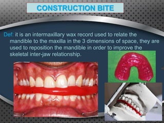 Bionator | PPT