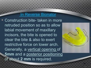 Bionator | PPT