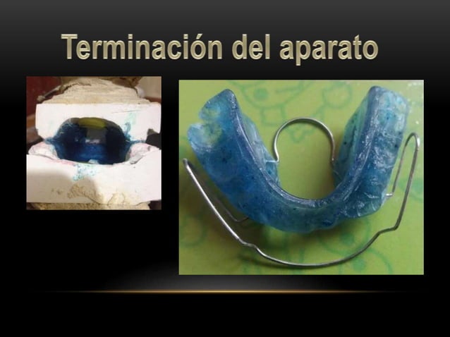 Bionator clase III | PPTX
