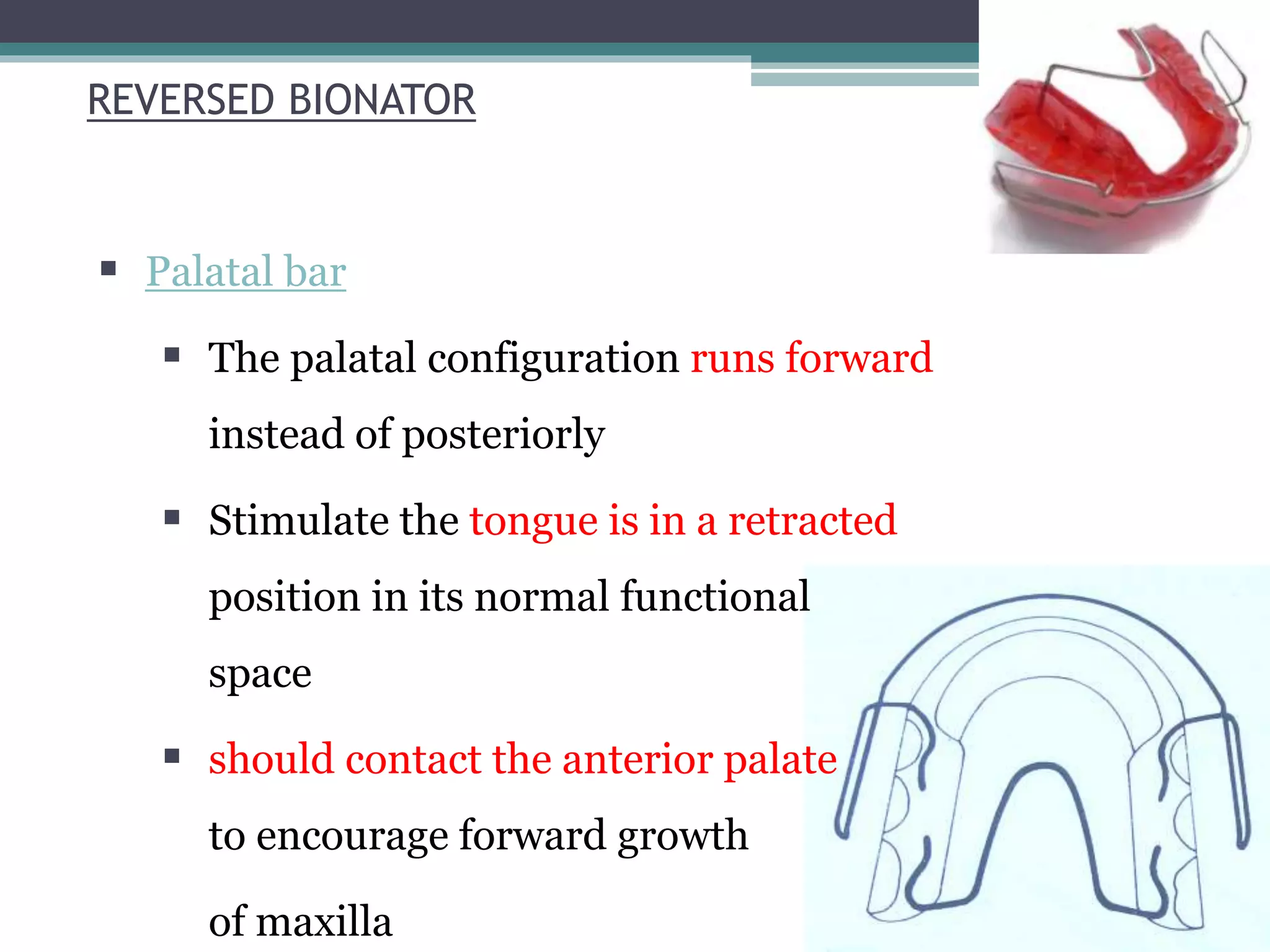 bionator | PPTX