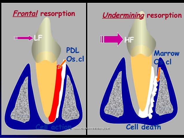 Biology of tooth movement