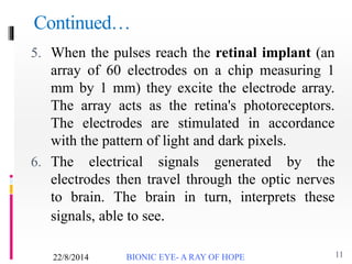 Bionic eye a ray of hope | PPT