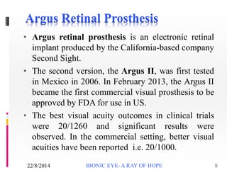 Bionic eye a ray of hope | PPT