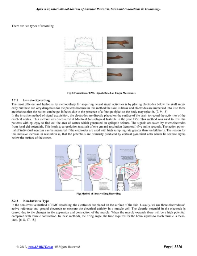 Bionic arm using muscle sensor v3 | PDF