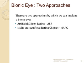 Bionic eye | PPTX