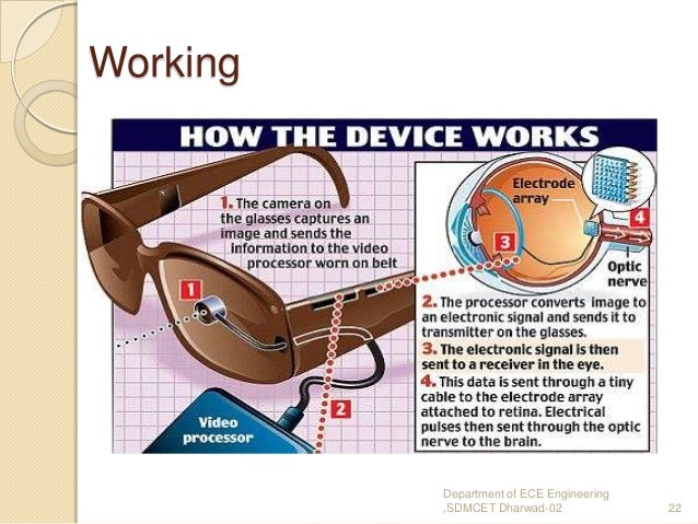 Bionic eye