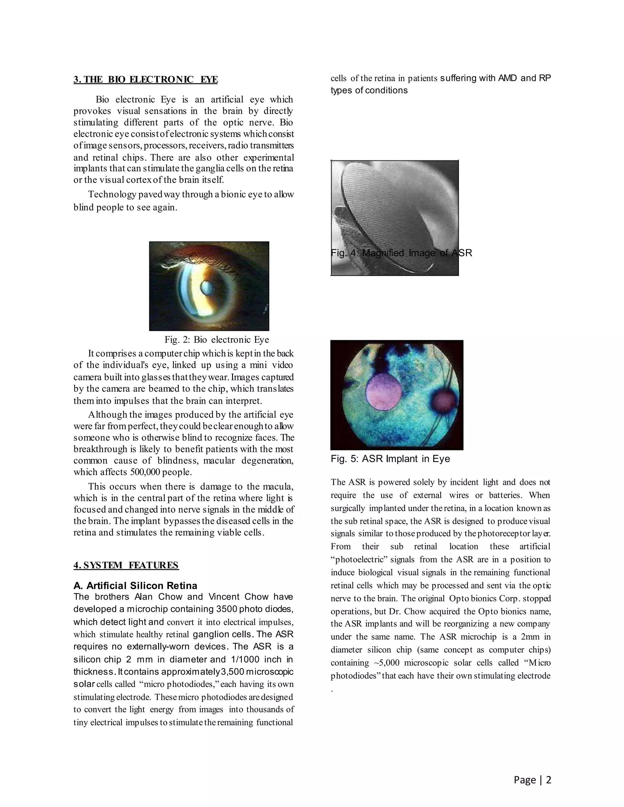 Bionic eye | DOCX
