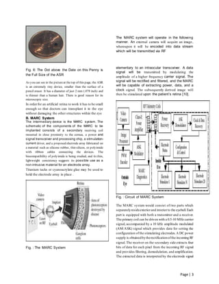Bionic eye | DOCX