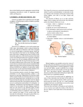 Bionic eye | DOCX