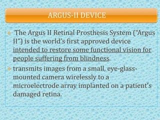 Bionic eye | PPTX