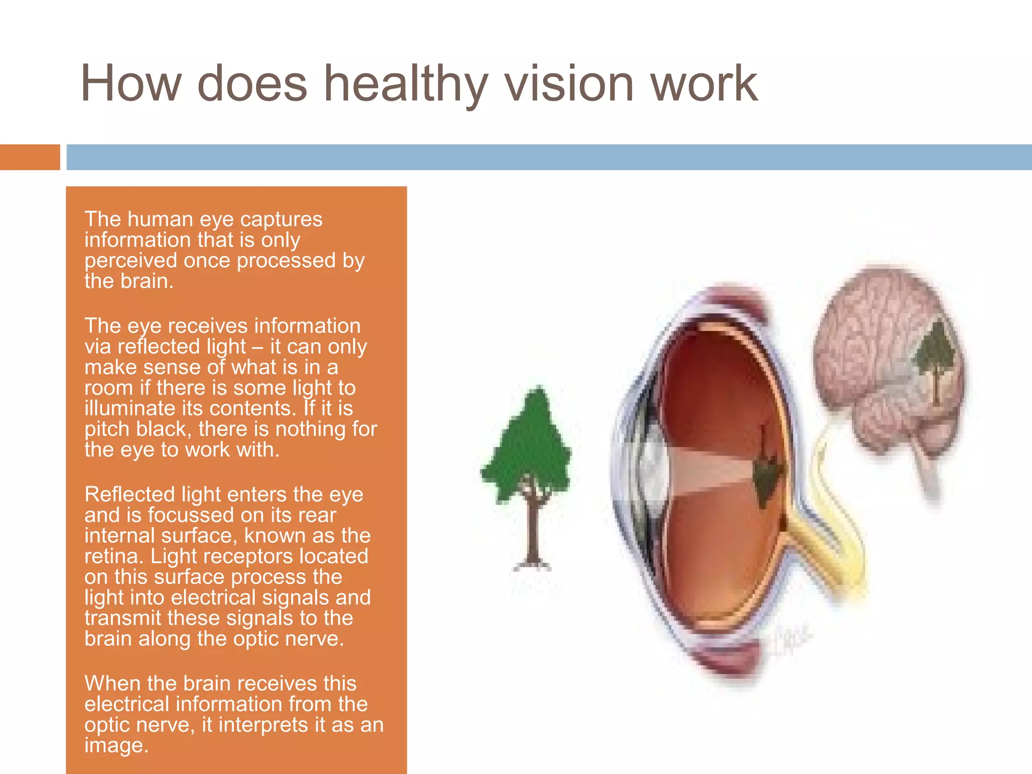 Bionic eye | PPT