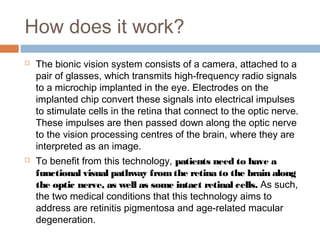 Bionic eye | PPT