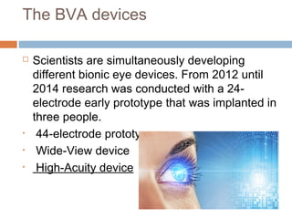 Bionic eye | PPT