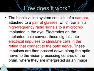 Bionic eye | PPT