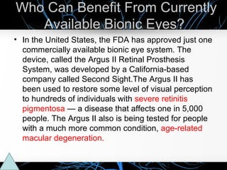 Bionic eye | PPT