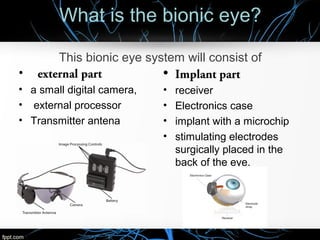 Bionic eye | PPT