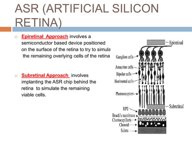 Bionic Eye Pptx